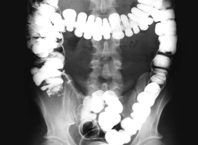 PÍLULAS | Exames de diagnóstico em risco | Outras Palavras